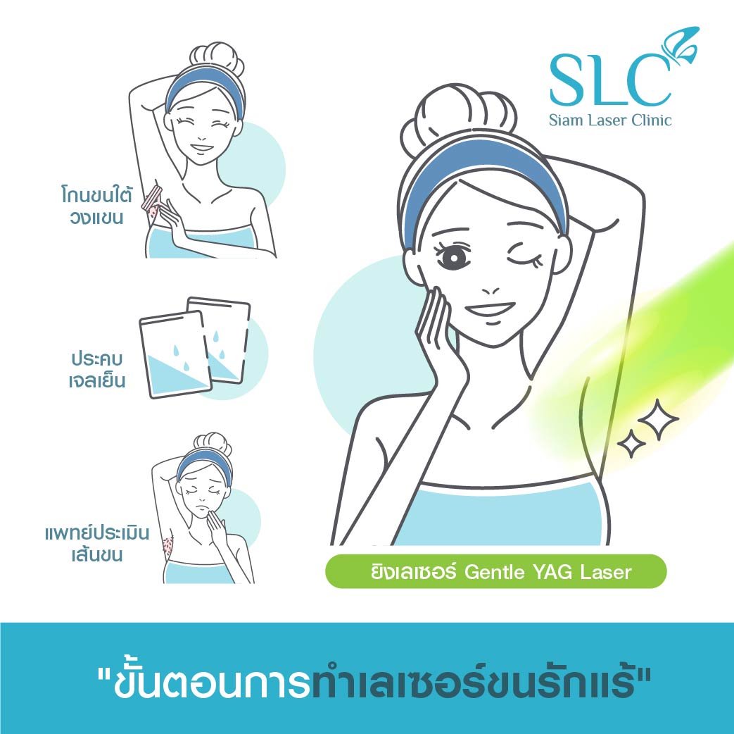 10 คำถาม ก่อนเลเซอร์ขนรักแร้ต้องรู้ Articles Slcclinicsandhospital