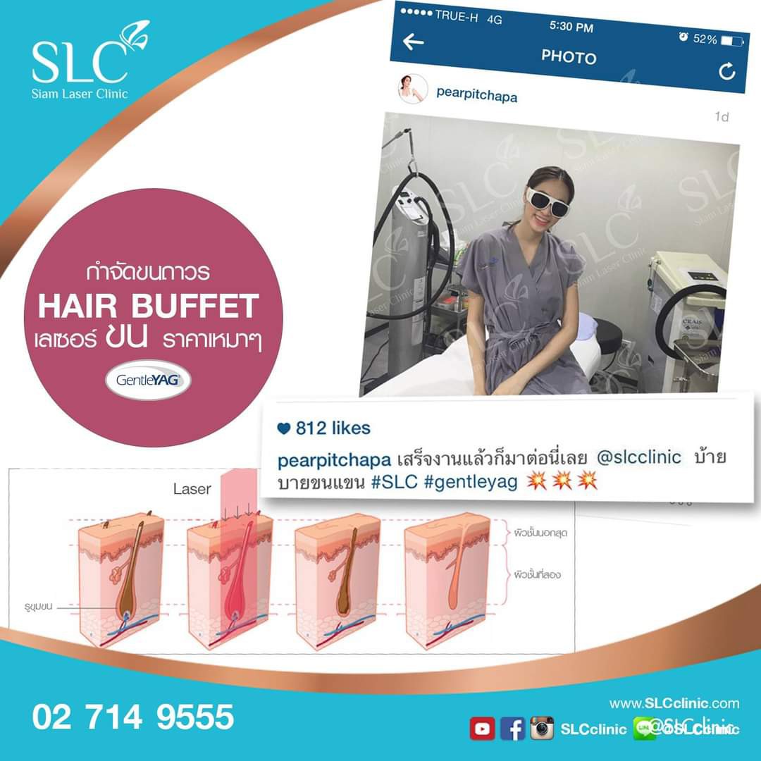 10 คำถาม ก่อนเลเซอร์ขนรักแร้ต้องรู้ Articles Slcclinicsandhospital